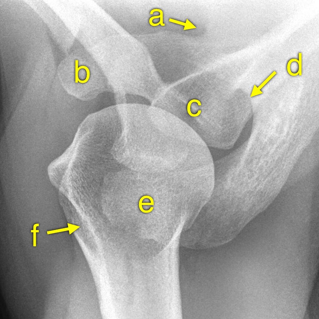 Shoulder Anatomy Quiz Printable Worksheets