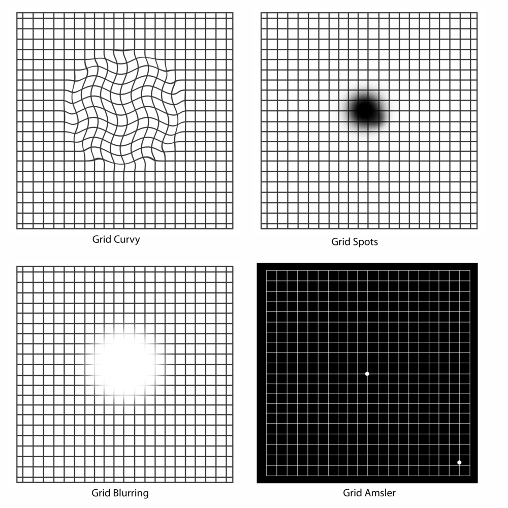 Macular Degeneration Chart To Print Printable Worksheets